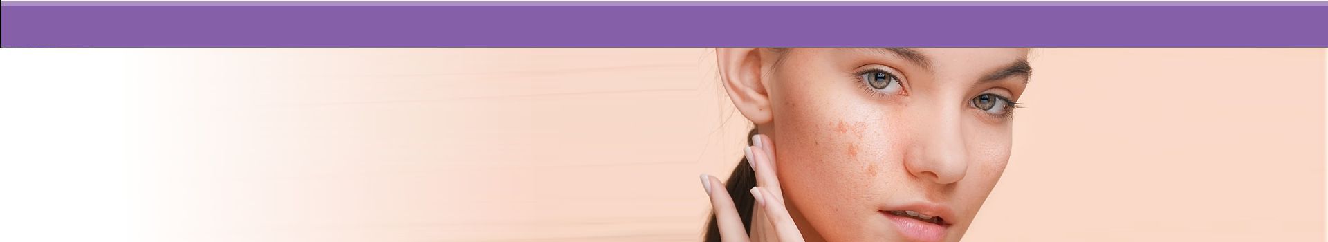 Macchie viso – Armonia Vicenza